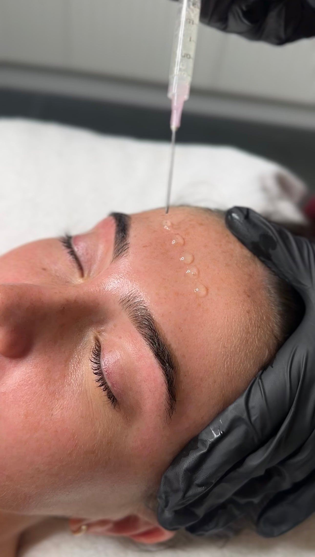 LBB Customised Fluid Primaluce Peels - Latari Bakri Beauty and Cosmetic ...